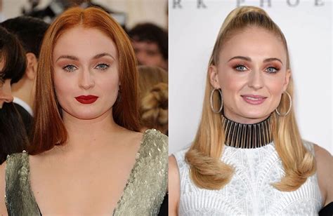 Are Cleft Chins Rare In Girls Bizrahmed