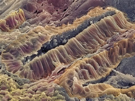 Ulcerative Colitis Sem Stock Image M1300641 Science Photo Library