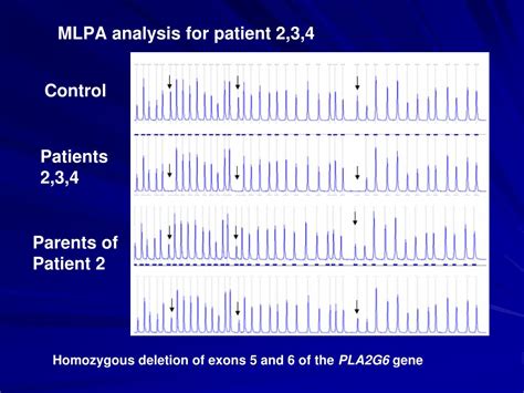 Ppt Comprehensive Mutation Analysis Of Pla2g6 In Infantile