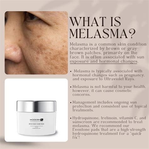 Dermatology Dermatologyoffice Melasma Modern Dermatology Of Michigan