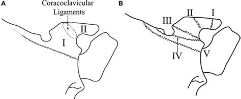 Fractures Of The Coracoid Process A Systematic Review Pmc