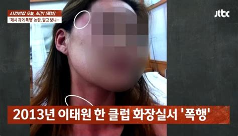 제시 일행에 맞은 적 있어그때와 수법 똑같아 과거 피해자 등판 Mlbpark