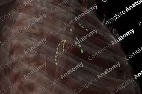 Superficial Axillary Nodes Left Complete Anatomy