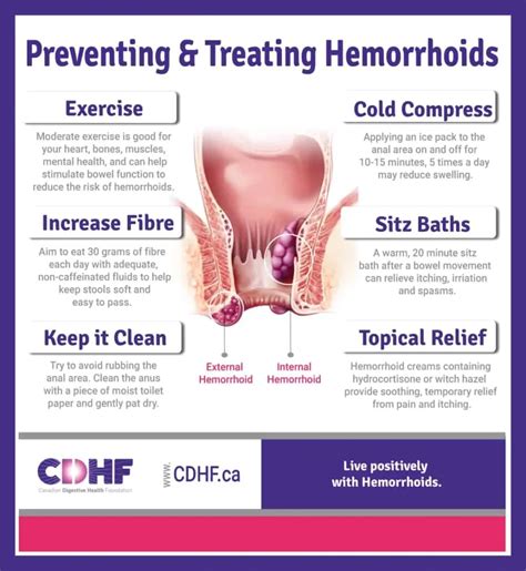 Bleeding External Hemorrhoids