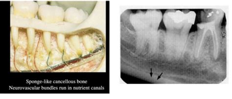 Nutrient Canal Radiograph