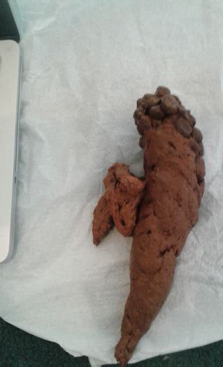 Huge Logs Image 1354 Thisvid Tube