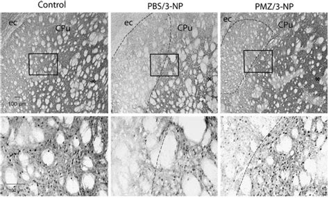 Calbindin Immunoreactivity In The Rat Striatum Showing Attenuation Of