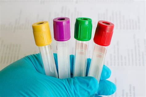 Premium Photo Blood Sample