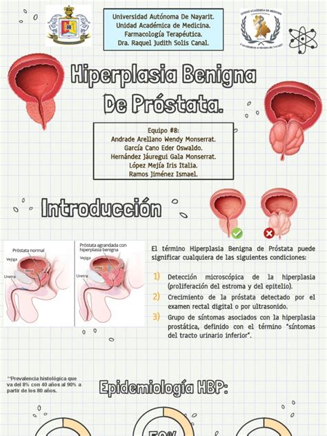 Hiperplasia Benigna De Próstata Pdf Cancer De Prostata Medicina