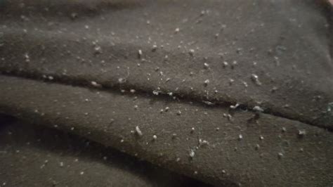 Paano Magtanggal Ng Himulmol Sa Mga Damit O Tela Youtube