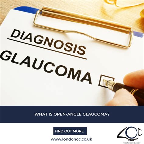 What Is Open Angle Glaucoma Londonoc Glaucoma