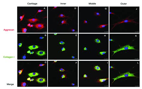 Collagen I And Aggrecan Staining Of Passage 2 Cultured Cells