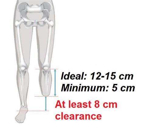 Guide Physical Therapy Guide To Below Knee Amputation 59 Off