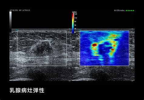 Asset Download Mindray