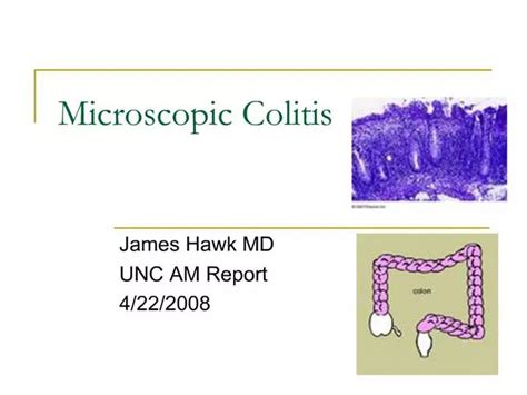 Ppt Microscopic Colitis Powerpoint Presentation Free Download Id