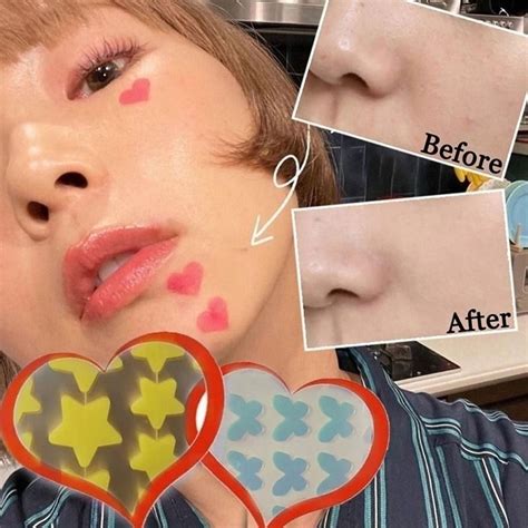 Jual Acne Patch Lucu Sticker Jerawat Hydrocolloids Pimple Patch Repair