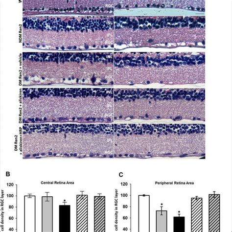 Onl Outer Nuclear Layer Opl Outer Plexiform Layer Inl Inner Download Scientific Diagram
