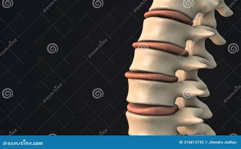 Bulging Disc In The Human Spine Stock Illustration Illustration Of Medical Diagnosis 316813742