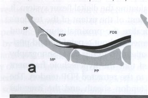 A Gallery Of High Resolution Ultrasound Color Doppler And 3d Images Musculoskeletal