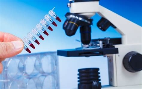 384 Well Pcr Plate Manufacturer In China