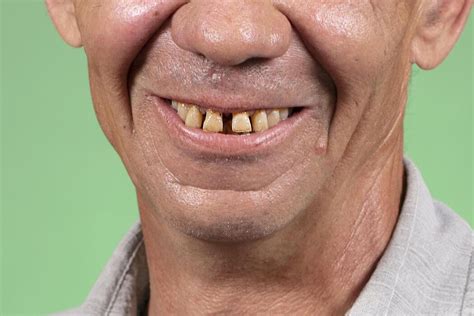 Ugly Face Definition And Meaning Mucmv