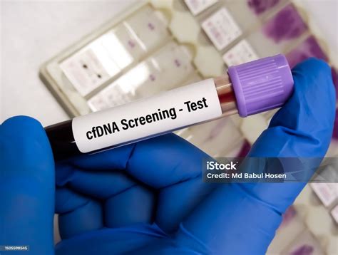 Blood Sample For Prenatal Cfdna Screening Test For Pregnant Women Down