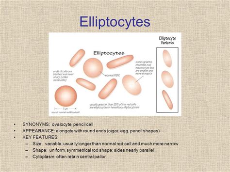 Elliptocytes