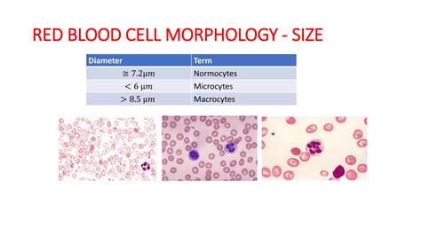 Peripheral Smear Stainingpptx