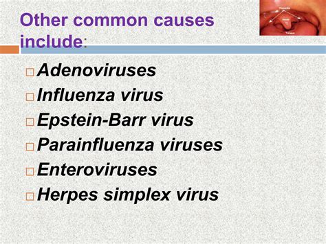 Nursing Management Of The Patient With Tonsillitis Ppt Pptx
