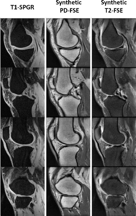 Susan Segment Unannotated Image Structure Using Adversarial Network