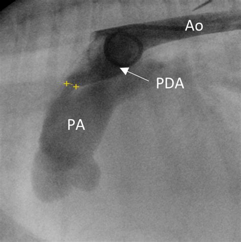 Pda In Dogs Surgery At Brenda Bradley Blog