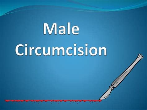 Circumcision Ppt