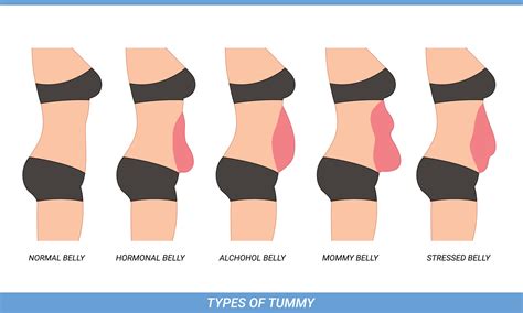 Illustration Of Types Of Tummies For Woman 10066626 Vector Art At Vecteezy