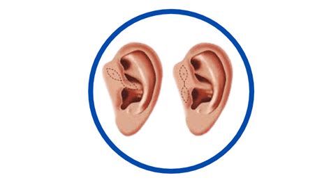 Preauricular Sinus Surgery Cost Save 10 Surgical Cost Dentist Atlanta Coast Dental