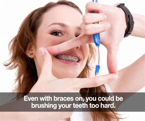 Is It Possible To Over Brush While You Have Braces