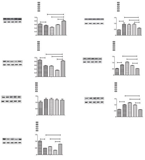 Bdnf Activates Pp2a And Inhibits Tau Phosphorylation Via The Pi3k Download Scientific Diagram