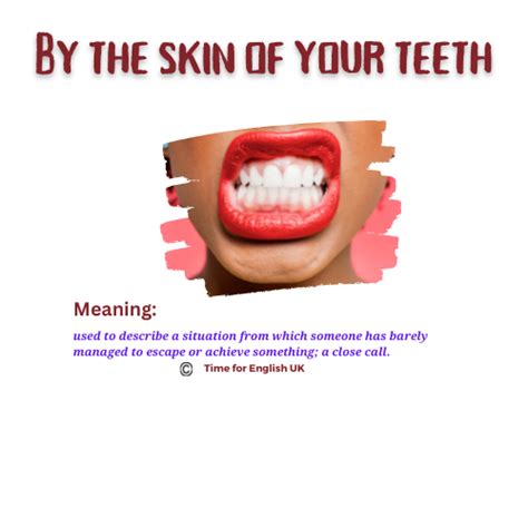 Distinction Là Gì Ý Nghĩa Ví Dụ Và Cách Sử Dụng Từ Distinction Trong