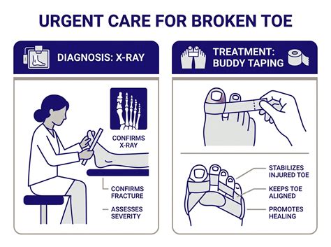 Urgent Care For Broken Toe X Rays Treatment And When To Go Cityhealth
