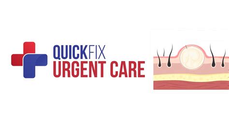 Abscess Boils Quickfix Urgent Care