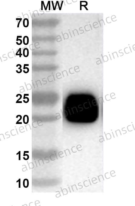 Recombinant Dog Il31 Protein C Hisabinscience