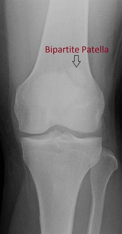 Imaging Case Of The Week 49 Emergucate