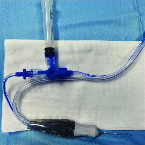 Connection Of The Syringe Containing The Vital Dye To The Vitrectomy