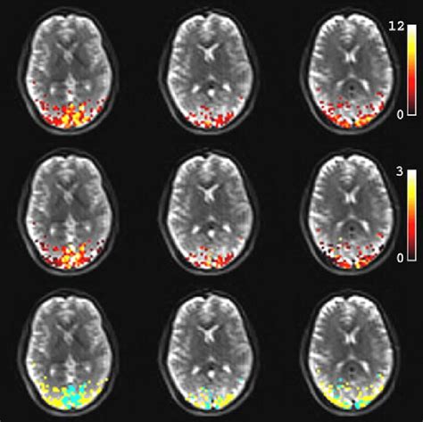 6 See Appendix For Colour Version Example Of Activation Maps From