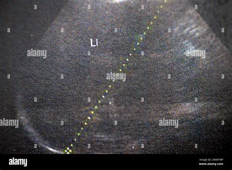 The Liver Is Average In Size 15 Cm With Homogeneous Echogenicity No Focal Lesions Or Dilated
