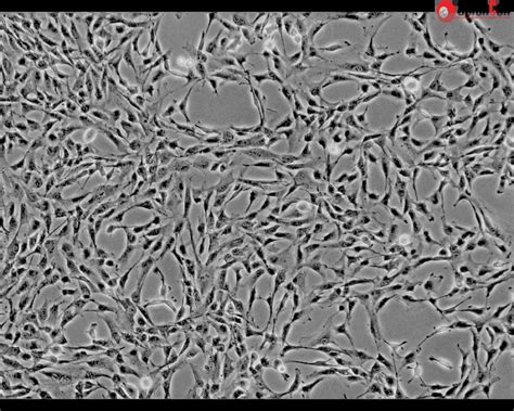 Human Liver Derived Mesenchymal Stem Cells Hmsc He
