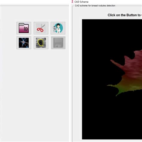 The Right Image Shows The Manual Segmentation Of The Margin Of The Download Scientific Diagram