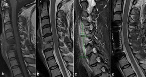 Surgical Neurology International