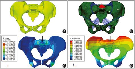 A Pelvic Solid Model B Finite Element Model Of The Pelvis And Its Download Scientific