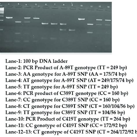 Digested And Undigested Pcr Products Of Cat Gene Genotypes Separated On