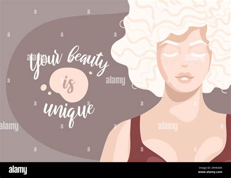 Beautiful Woman With Albinism And Curly Hair Body Positivity Concept